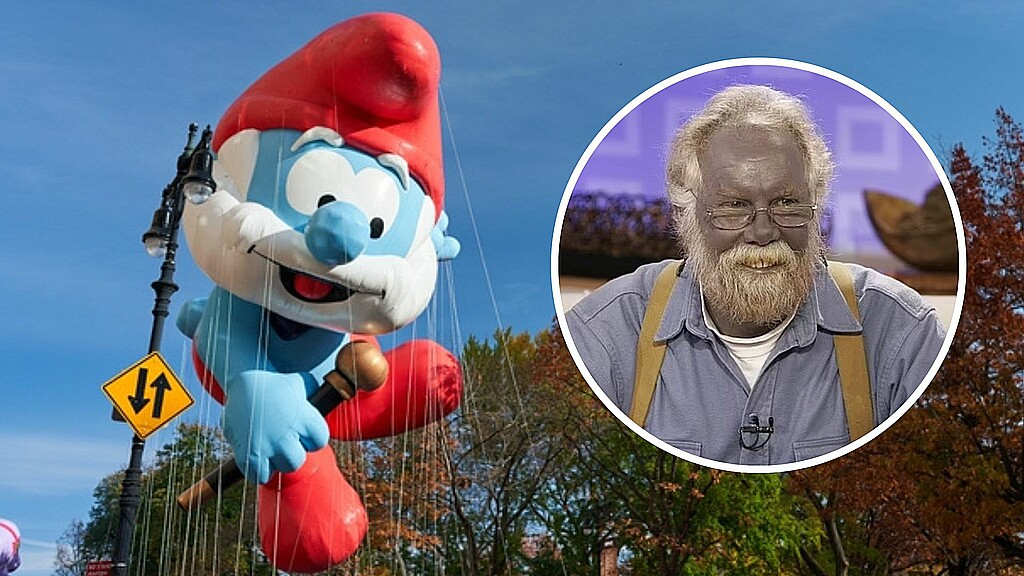 Paul Karason, el “Papá Pitufo” que se volvió azul por una extraña enfermedad incurable | ADN América